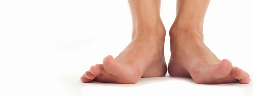 Flat Feet - Symptoms, Diagnosis and Treatment - Healthway Medical